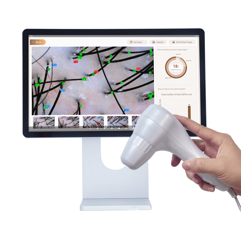 AI hair analyzer for scalp sensitivity, hair follicle and density analys